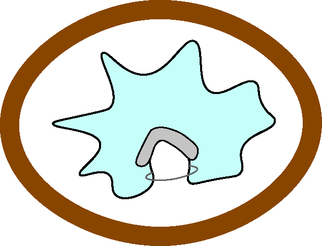 大腸ポリープ切除術について - 西宮敬愛会病院 COKU 鼠径ヘルニア・内視鏡センター